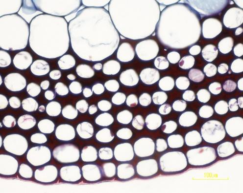 Differentiate between parenchyma collenchyma and sclerenchyma class 9 ...
