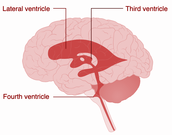 Third Ventricle Thalamus