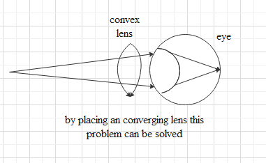 Least distance of distinct vision of a person is observed as 35 cm ...